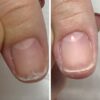 15 common nail conditions & how to deal with them – Scratch