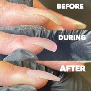 15 common nail conditions & how to deal with them – Scratch