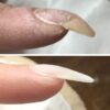 15 common nail conditions & how to deal with them – Scratch