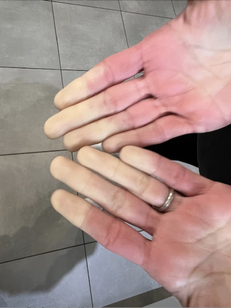 Life as a nail tech with Raynaud’s: 5 pros share their experiences ...