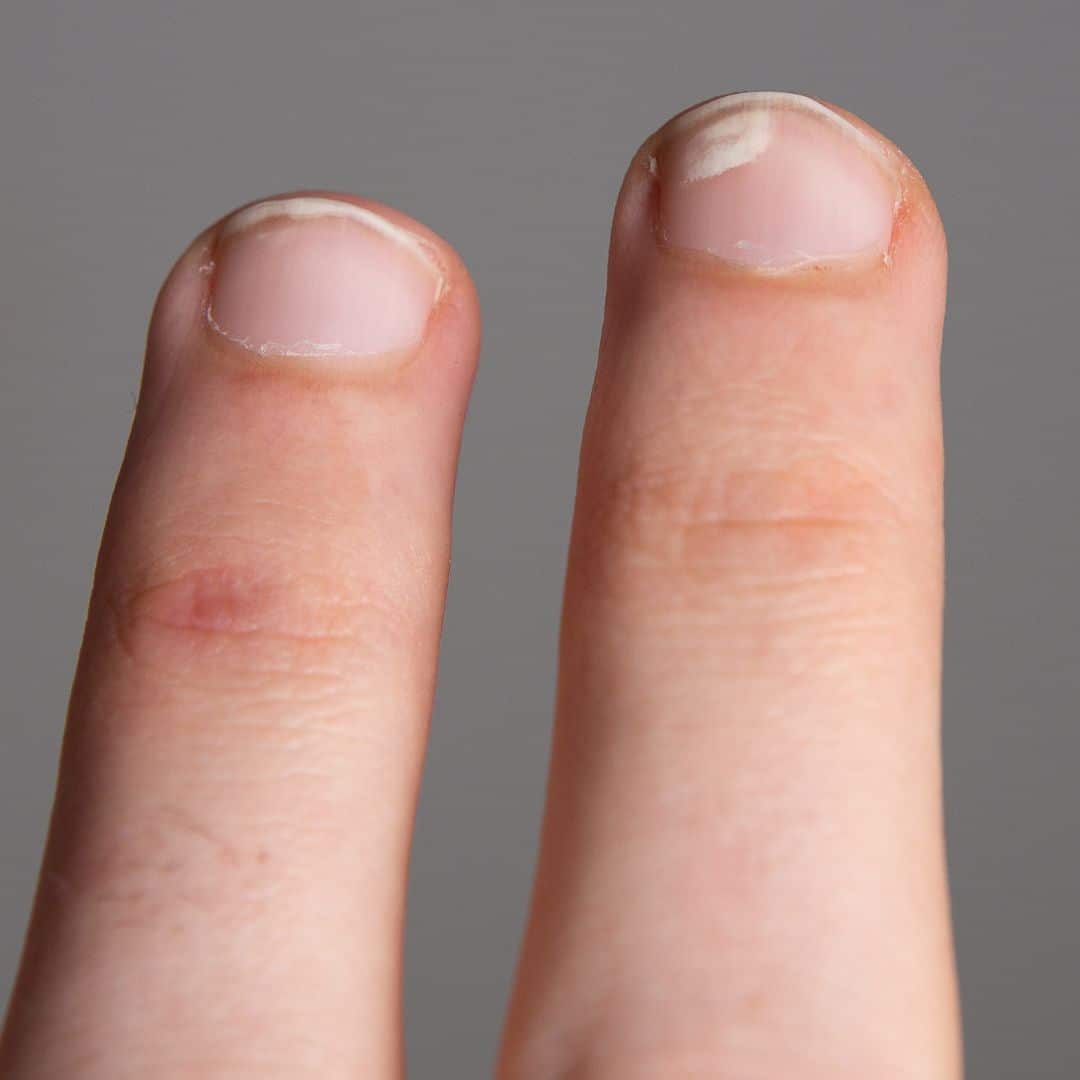 What is the nail matrix & why does caring for it matter?